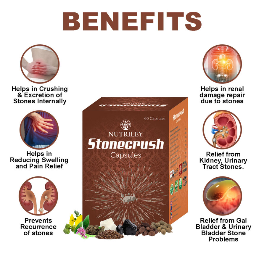 CRD Ayurveda Stoncrush – Stone Care Capsules (60 Capsules) – CRD Ayurveda